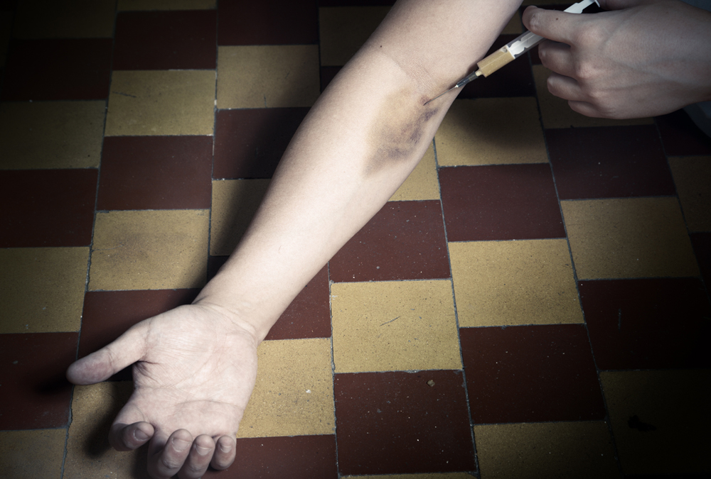 First US Cases Of Flesh-Eating Drug Krokodil Reported In Arizona - Redorbit