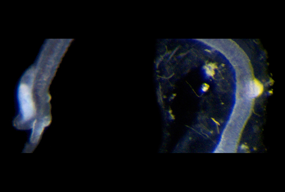 Unique New Worm Species Has Reversed Its Own Evolution - Redorbit