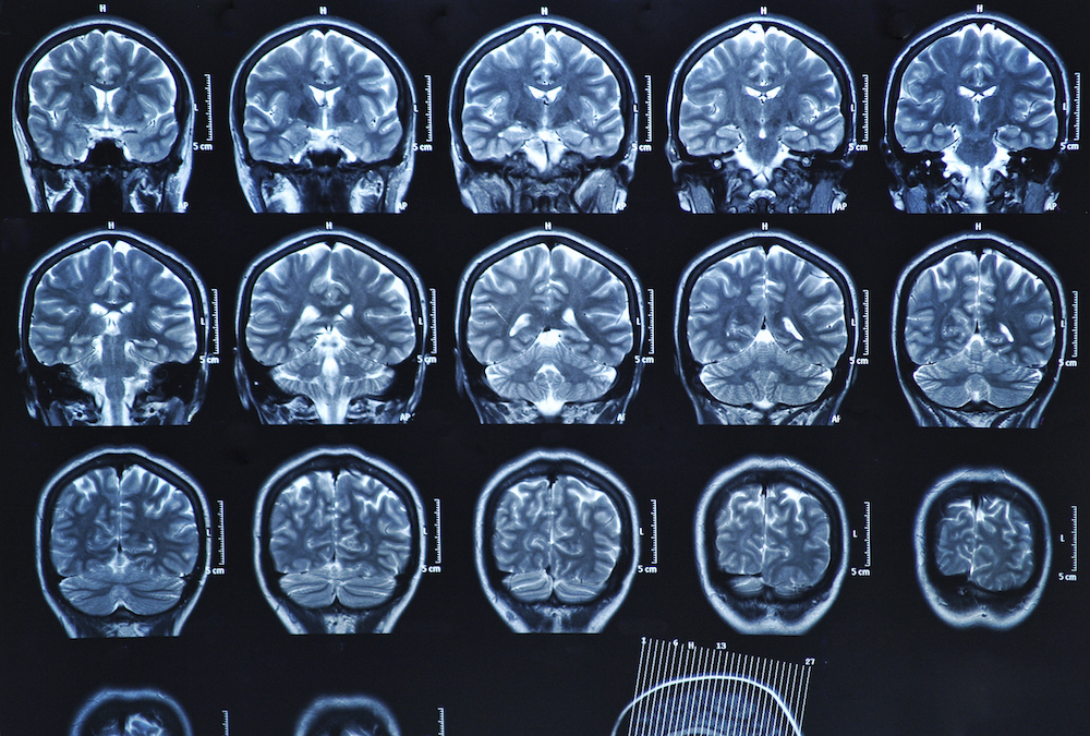 Scientist Scanned His Brain 2X A Week For More Than A Year And What He Scientist Scanned His Brain 2X A Week For More Than A Year And What He